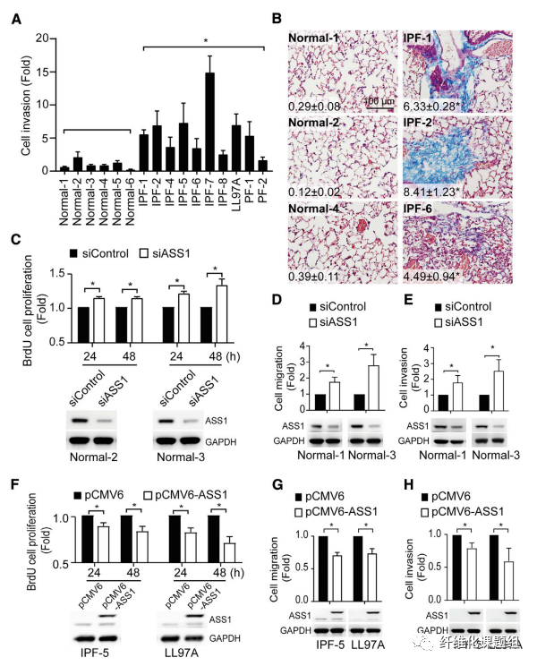 Mol Ther | 精氨酸琥珀酸合成酶1(ASS1)的缺失在肺纤维化中的治疗靶点作用